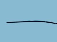 China BF-P150 Bronchoscope Flexible Scope 180 Degree with 2.0mm Instrument Channel 5.4mm for sale