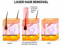 China OPT IPL / OPT Multifunctional Machine Portable IPL Fast Hair Removal for sale
