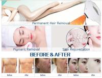 China OPT IPL / OPT Multifunctional Machine Portable IPL Fast Hair Removal for sale