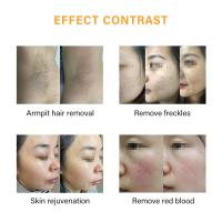 China IPL OPT Diode Laser Hair Removal Equipment 480NM SHR Home Use Beauty Machine for sale