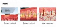 China 480nm 530nm SHR Diode Laser Hair Removal IPL Ice Cold Beauty Equipment for sale