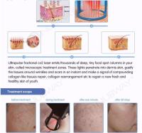China Stationary Fractional Laser Co2 Machine Scar Removal Infrared Skin for sale