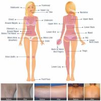 China Flawless 808nm Diode Laser Painless Hair Removal Machine for sale