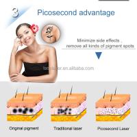 China 755nm 1064nm DPL Laser Hair Removal Diode Rf Skin Tightening Device for sale