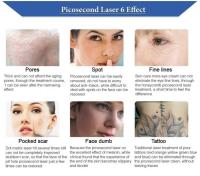 China Painless Medical Picosecond Laser Machine 532nm Q Switch Yag for sale