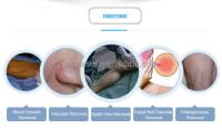 China Home Use Laser Tattoo Removal Machine Therapy Device Fungal Remover Onychomycosis Cure for sale