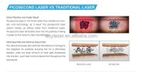 China 4 Wavelengths Honeycomb Nd Yag Laser Picosecond Laser 1064nm Tattoo Delete Machine for sale
