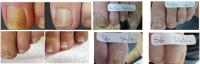 China 100-2000mj Photo Rejuvenation Machine 300w Nd Yag 1064 Laser for sale