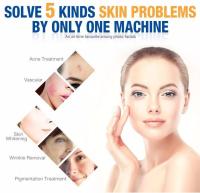 China SHR IPL Laser Hair Removal Machine for sale