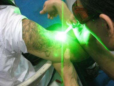 China Dermatology Neodymium picolaser Nd Yag Laser 1064nm Portable for sale