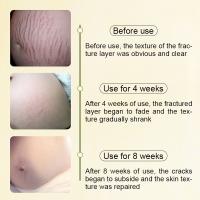 China Natural Pregnancy Belly Cream with 9 Oils - Moisturizing Skincare for Postpartum Mothers - 100ml Daily Care for sale