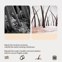 China Blue Copper Peptide Anti-Hair Loss Serum 120ml with Natural Plant Extracts for Hair Follicle Activation for sale