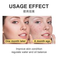 China PHA Mild Exfoliating Toner and Essence Water 150ml for Sensitive Skin Pore Tightening for sale