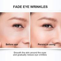 China Retinol Anti-Wrinkle Regeneration Eye Cream with Vitamin C - 7 Day & 28 Day Visible Results for Dark Circles and Aging Skin for sale