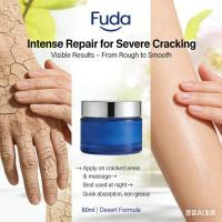 China All-Day Deep Moisturizing Hand and Foot Crack Cream for sale