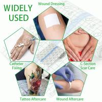 China Matte Waterproof Medical Adhesive Tape PU Film Self Adhesive Wound Dressings for sale