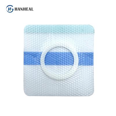 China Skin Friendly Breathable Clear Wound Dressings for Baby's Navel Neonatal Hip Hernia for sale