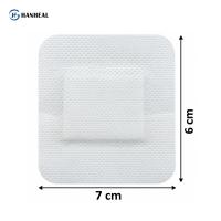 China Sterile Self-Adhesive Non-Woven Wound Dressing - Breathable, Absorbent, and Skin-Friendly for Postoperative Wounds for sale