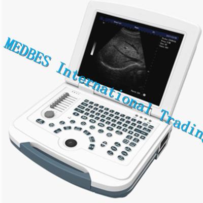 China 15 Inch High Definition LED Screen Handheld Ultrasound Scanner Machine with Built-in Battery for sale
