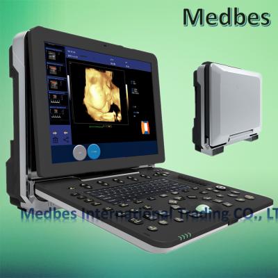 China Windows 4D Portable  Color Doppler Ultrasound Scanner  Ultrasound System Scanner for sale