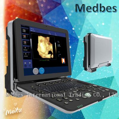 China 4D Portable Echocardiography Machine 2D Echo Color Digital Portable Ultrasound Scanner for sale