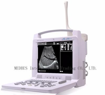 China Labtop Ultrasound Scanner Machine with 2 connectors for sale