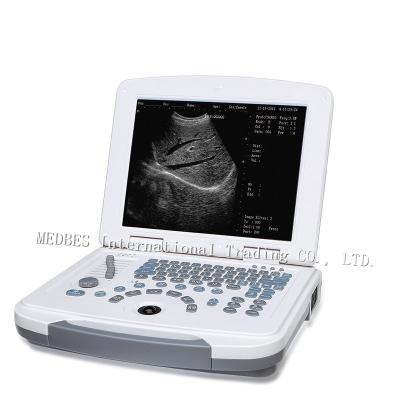 China Clinic 80 elements Laptop Ultrasound Machine B580 with Battery for sale