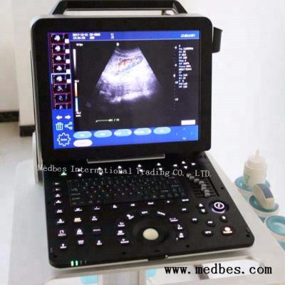 China 4D Portable Echocardiography Machine 4D Echo Color Digital Portable Ultrasound Machine for sale