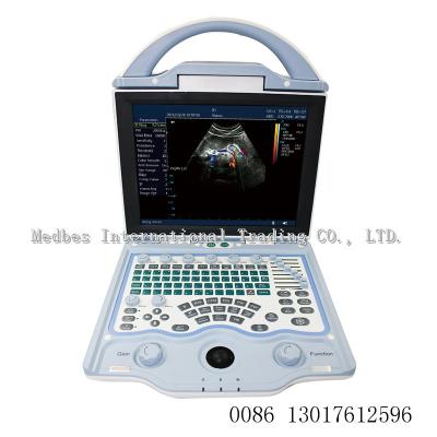 China 2 ultrasonic transducer Portable3D Color doppler ltrasound Scanner  portable ultrasound machine for pregnancy for sale