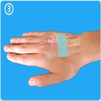 China PLC Control KR-LZT-A 3 M Tegaderm Cannula Fixator For IV Dressing for sale