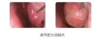 China Low Temperature RF Plasma System Cutting Perforation Ablation Cryosurgery Unit for sale