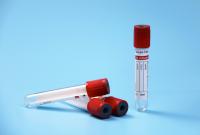 China Red Closure Vacuum Blood Collection Tube Plain With No Additive for sale