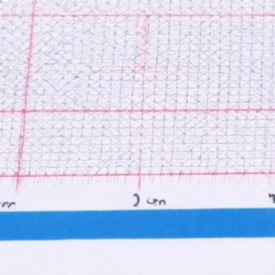 China Super Fast Barrier Rectifier LangJie MUR1009 10A Diode with Metal Silicon Junction and Halogen Free Compliance for sale