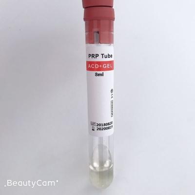 China High Efficiency PRP SST Blood Test Tube with ISO 13485 Certification for Medical Applications for sale