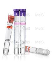 China Medical Glass SST Blood Test Tube with 5ml Capacity and 2-Year Shelf Life for Serum Separation for sale