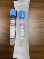 China Sarstedt SST Blood Test Tube 13x75mm 5ml with Serum Separation Gel for Medical Diagnostics for sale