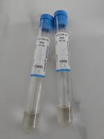 China Disposable Vacuum Sterile ACD+GEL+HA Blood Collection Tube for Clinical Trials - 10mL Capacity for sale