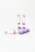 China Disposable K2EDTA SST Blood Test Tube 1-10ml Glass Cap for Hematology for sale