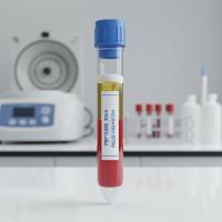 China PRP Tube 30ml Vacuum Blood Collection Tube for Platelet Rich Plasma Preparation with 2 Year Shelf Life for sale