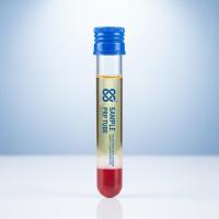 China PRP Tube 10ml with Sodium Citrate Anticoagulant for Platelet Rich Plasma Preparation Custom Logo for sale