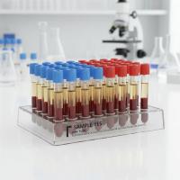 China PRP Tube 10ml Sodium Citrate Anticoagulant for Platelet-Rich Plasma Preparation Blood Collection for sale