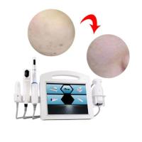 China Smas Lift Vmax HIFU Vaginal Tightening Machine RF Microneedling Liposonic Body Slimming for sale