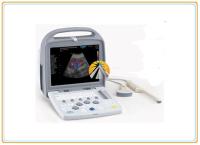 China Smart Ultrasound Scan Machine Portable Color Doppler Fashionable Design for sale