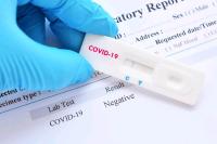 China SARS-CoV-2 COVID 19 Antibody Lab Rapid Test IgM IgG Detection Kit for sale