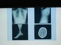 China Konida X Ray Medical Imaging Film Waterproof For Agfa Printer for sale