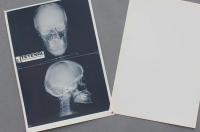 China White Medical Paper Chest X Ray Film Waterproof High Sharpness for sale