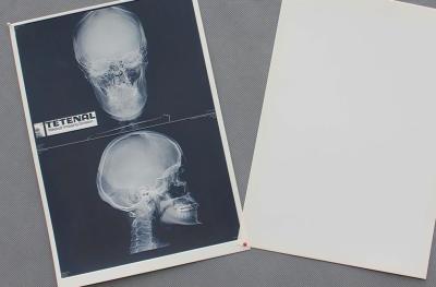 China White Medical Paper Chest X Ray Film Waterproof High Sharpness for sale