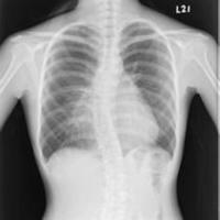 China KND-A / F Medical X Ray Films for sale