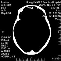 China Konida Digital X-ray Medical Dry Thermal Printer Film KND-A, KND-F for sale