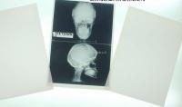 China Degradable White Base Xray Paper Medical Film For Laser Printer for sale